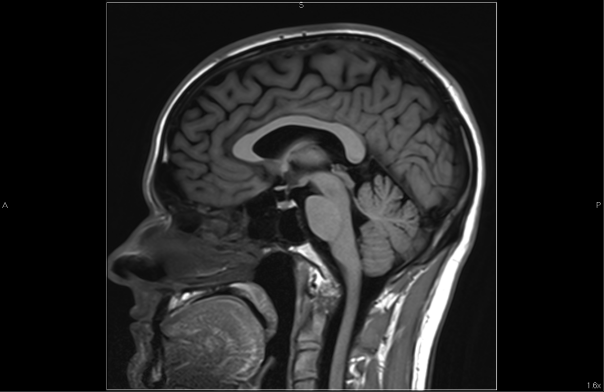 MRI CT Combination - The Radiology Clinic