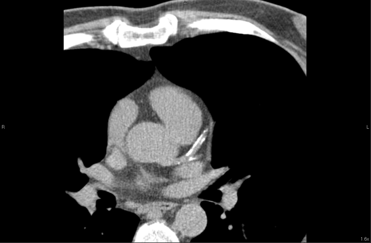 MRI CT Combination - The Radiology Clinic