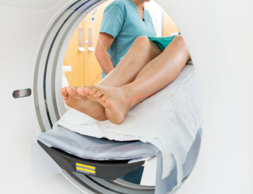 MRI of the Ankle and Foot for Plantar Fasciitis | Rockville MD